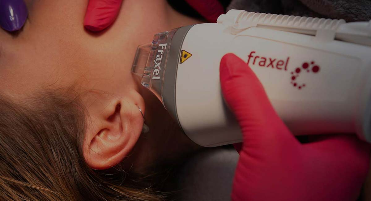 Fraxel Laser Treatment, Laser Skin Resurfacing & Scar Repair Lee's ...