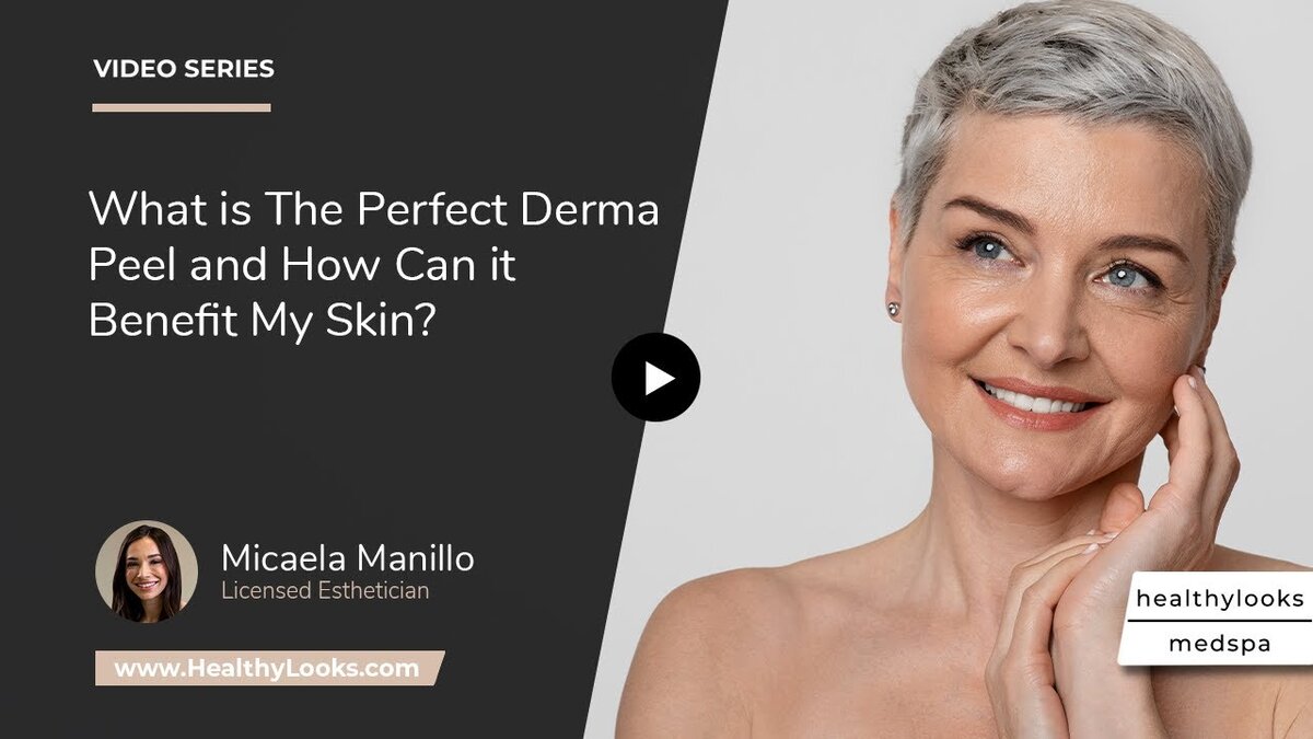 What is The Perfect Derma Peel and How Can it Benefit My Skin ...